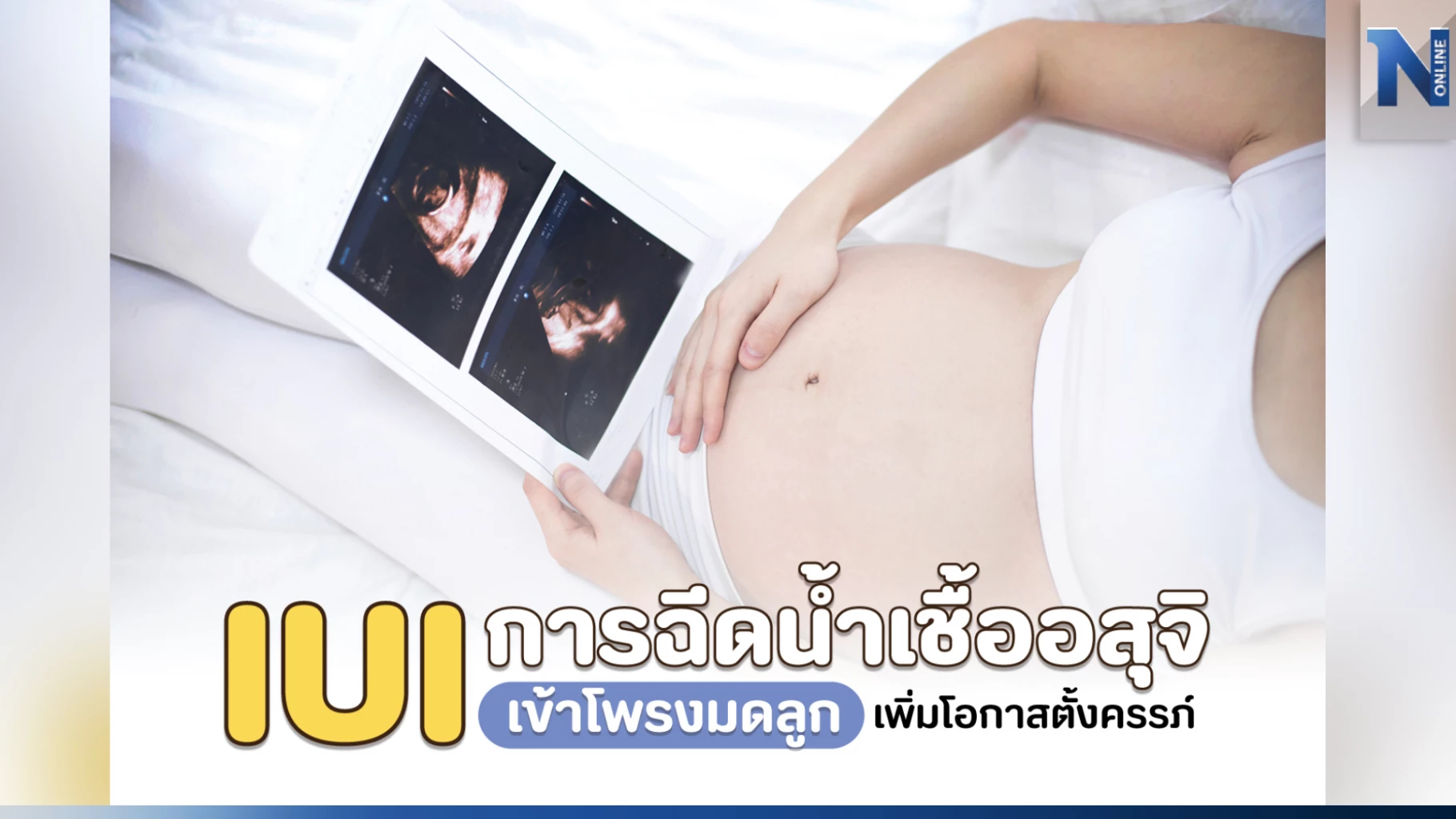 IUI การฉีดน้ำเชื้ออสุจิเข้าโพรงมดลูก เพิ่มโอกาสตั้งครรภ์